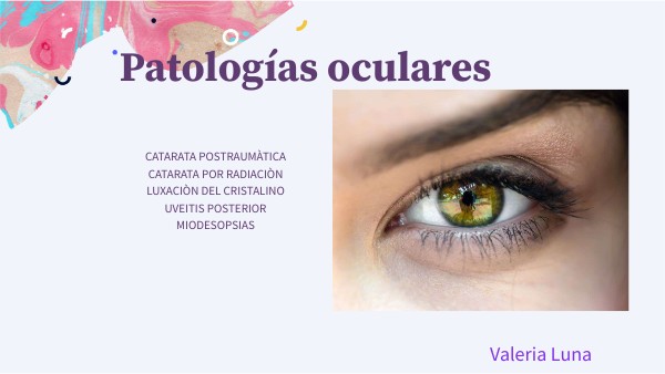 Las 3 Patologías Oculares Más Frecuentes Según La Oms – AABB